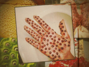 Trypophobia: The awful and incurable fear of tiny clusters of holes