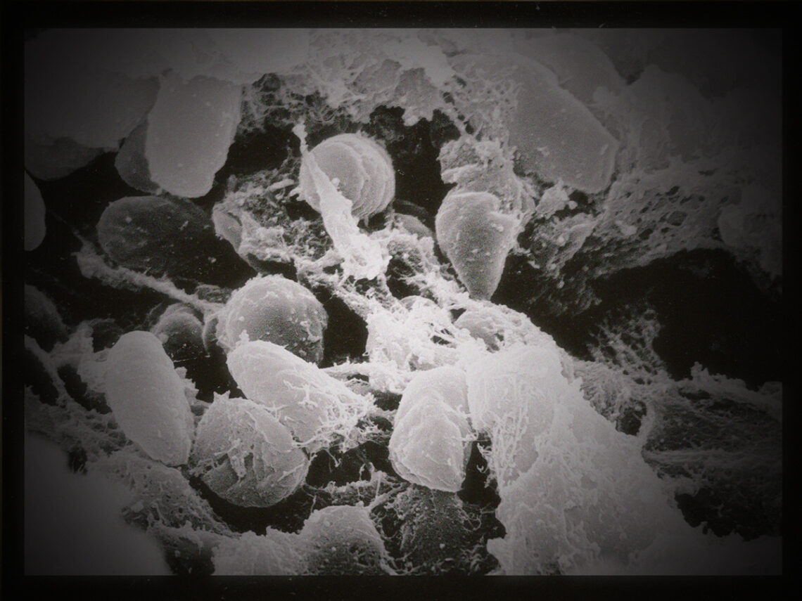 Black Plague Virus