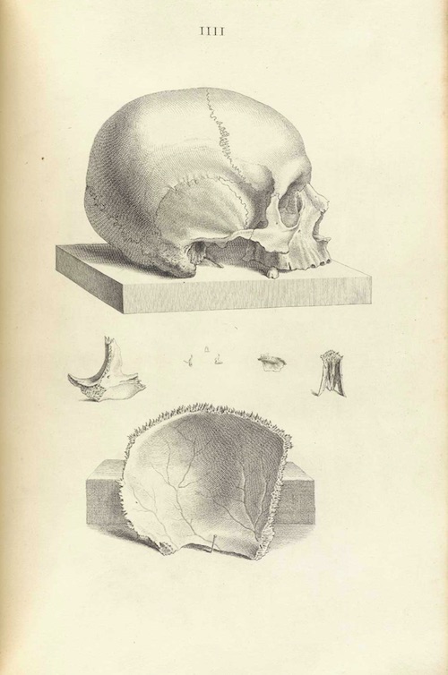 Skeletal remains: The first accurate representation of ‘The Anatomy of ...